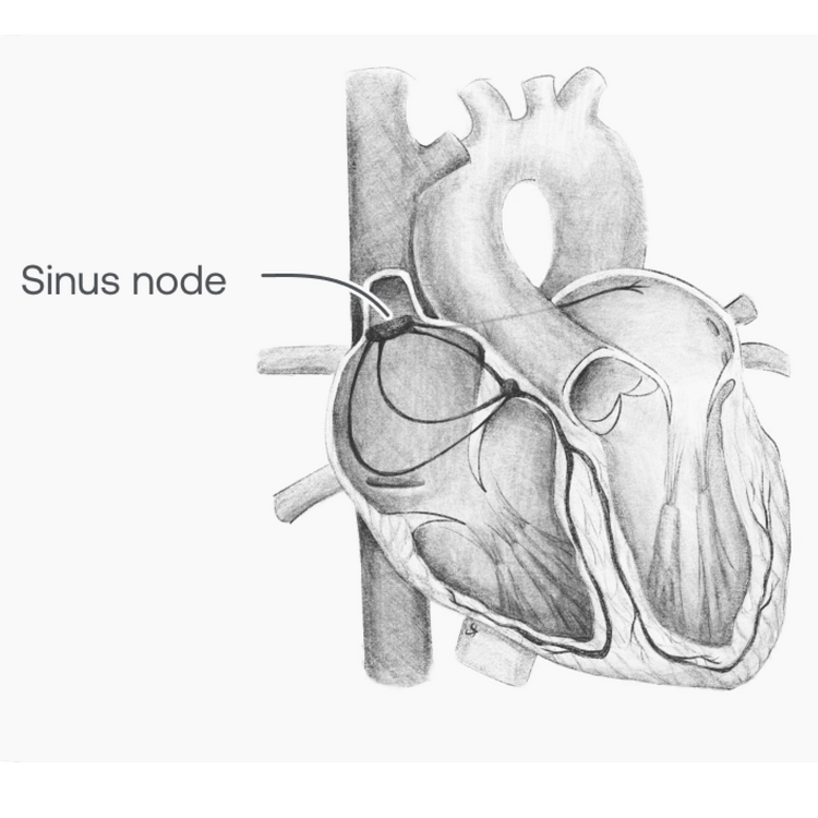 Eko Health | Sinus Node and Atrial Depolarization
