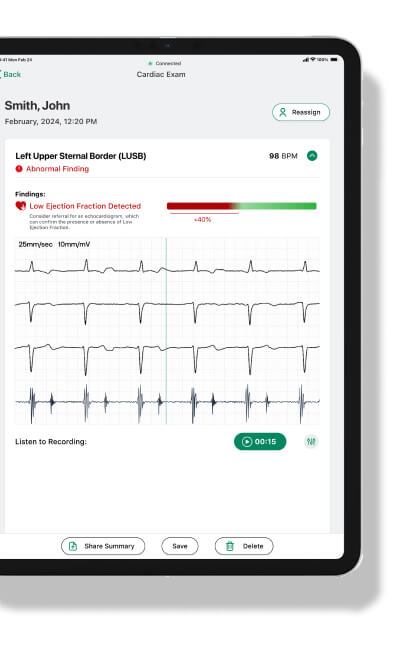 Eko Digital Stethoscopes, AI Disease Detection, & Telehealth – Eko Health